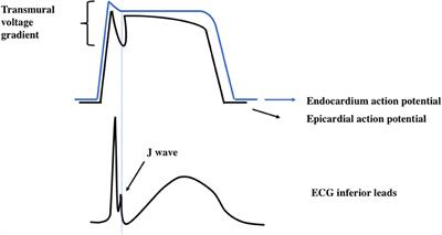 Frontiers | Electrophysiological Basis for Early Repolarization Syndrome