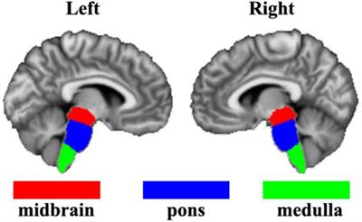 Frontiers | Increased Functional Connectivity Between Medulla and ...