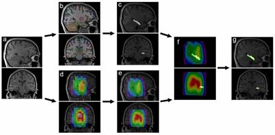 Frontiers | Automated ROI-Based Labeling for Multi-Voxel Magnetic ...