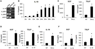Frontiers | Blocking IL-19 Signaling Ameliorates Allergen-Induced ...