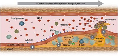 Atherosclerosis Process