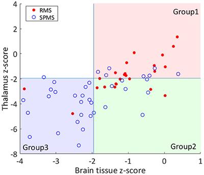 Frontiers | Thalamic Atrophy Without Whole Brain Atrophy Is Associated ...
