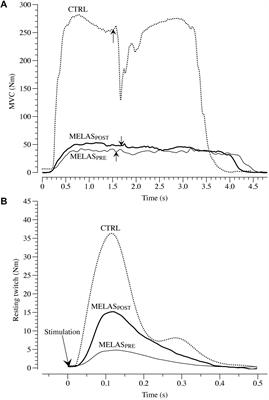 Frontiers | Neuromuscular and Muscle Metabolic Functions in MELAS ...