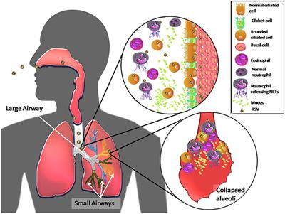 Frontiers | Host Components Contributing to Respiratory Syncytial Virus ...