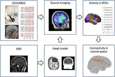 Frontiers | Network Perspectives on Epilepsy Using EEG/MEG Source ...