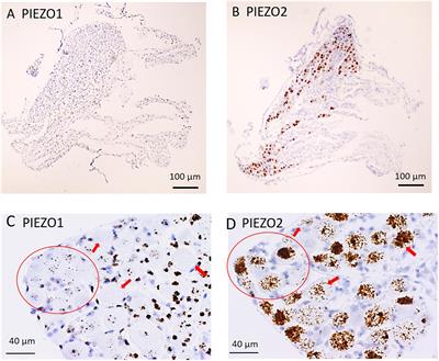 Frontiers | PIEZO1 Is Selectively Expressed in Small Diameter Mouse DRG ...