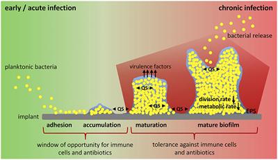 Frontiers | Chronic Implant-Related Bone Infections—Can Immune ...