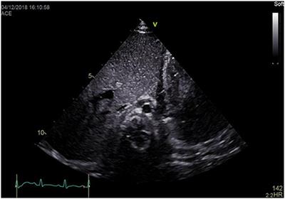 Frontiers | Subcostal Echocardiographic Imaging in Neonatal and ...