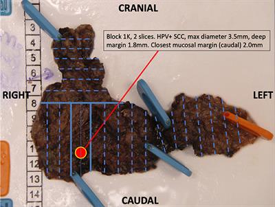 Frontiers | Quality Assessment Across Disciplines in Head and Neck ...