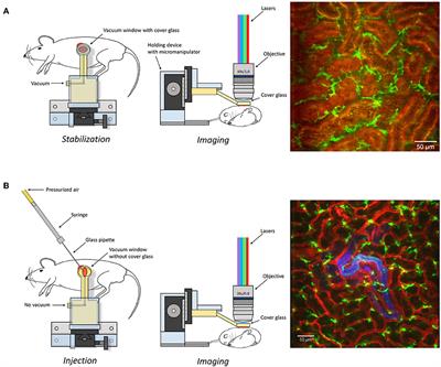 Frontiers | High Resolution Intravital Imaging of the Renal Immune ...