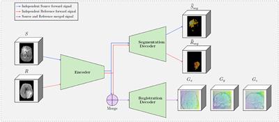 Frontiers | Deep Learning-Based Concurrent Brain Registration and Tumor ...