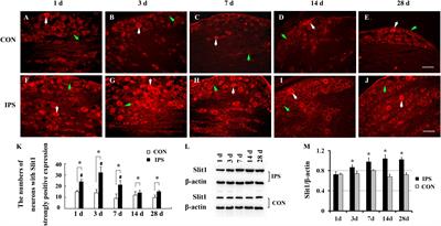 Frontiers | The ATP-P2X7 Signaling Pathway Participates in the ...