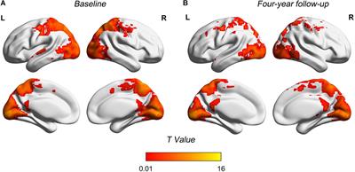 Frontiers | Longitudinal Changes in Whole-Brain Functional Connectivity ...