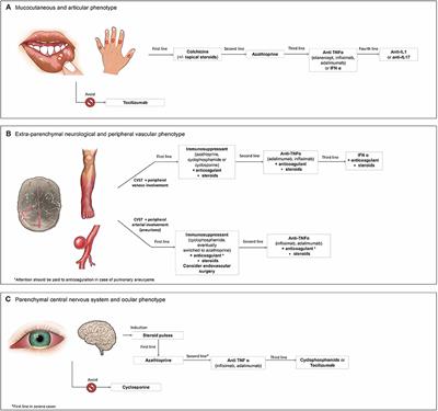 Frontiers | Treating the Different Phenotypes of Behçet's Syndrome