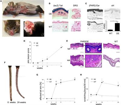 Frontiers | Protease-Activated Receptor-2 Regulates Neuro-Epidermal ...