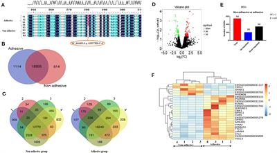 Frontiers | Transcriptomic Study of Porcine Small Intestine Epithelial ...