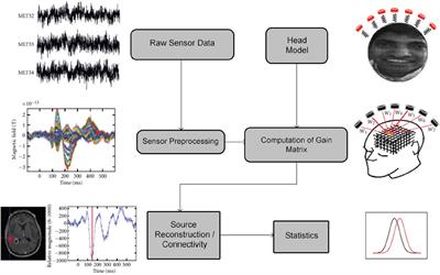 Frontiers | NUTMEG: Open Source Software for M/EEG Source Reconstruction