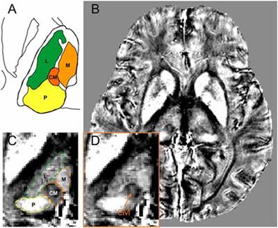 Thalamus Anatomy Mri