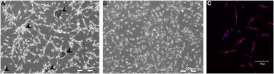 Frontiers | Human Melanocyte-Derived Spheroids: A Precise Test System ...