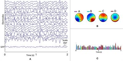 Frontiers | Normal Aging: Alterations in Scalp EEG Using Broadband and ...