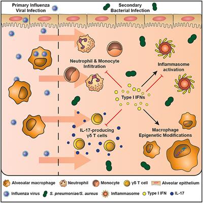 Bacterial Pneumonia Cell