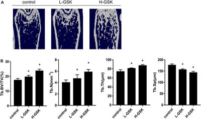 Frontiers | Positive Effect of Gushukang on Type-H Vessel and Bone ...
