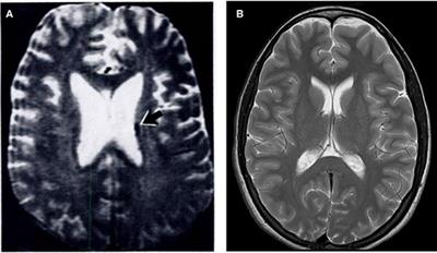 Frontiers | Low-Field MRI: How Low Can We Go? A Fresh View on an Old Debate
