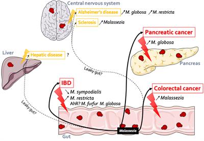 Frontiers | Overview of the Potential Role of Malassezia in Gut Health ...