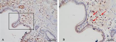 Frontiers | Differences in Clinical Features and Diagnostic Strategies ...