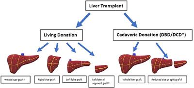 Frontiers | The Human Immune Response to Cadaveric and Living Donor ...