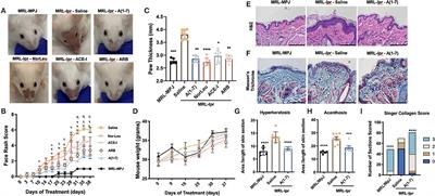 Frontiers | Targeting the Protective Arm of the Renin-Angiotensin ...