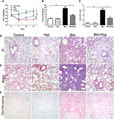 Frontiers | Hyperoside Attenuates Bleomycin-Induced Pulmonary Fibrosis ...