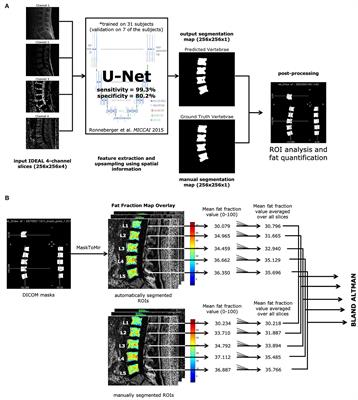 Frontiers | Automatic Vertebral Body Segmentation Based on Deep ...