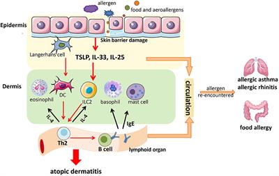 Irritant Contact Dermatitis Pathophysiology