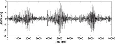 Frontiers | Critical Appraisal of Surface Electromyography (sEMG) as a ...
