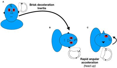 Horizontal Canal Repositioning Maneuver