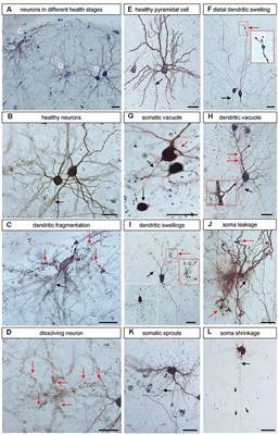 Frontiers | Genetically Encoded Calcium Indicators Can Impair Dendrite ...
