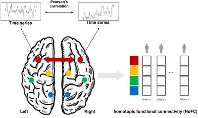 Frontiers | Functional Integration Between the Two Brain Hemispheres ...