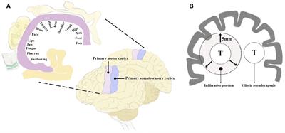 Frontiers | Surgical Management of Brain Metastases in the Perirolandic ...