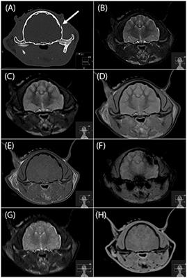 Frontiers | Agreement of Magnetic Resonance Imaging With Computed ...