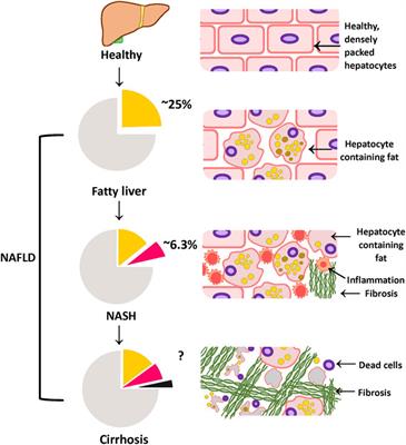 Frontiers | Non-Alcoholic Steatohepatitis: A Review of Its Mechanism ...