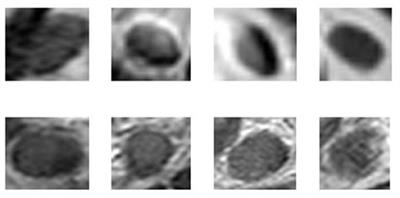 Frontiers | Different Machine Learning and Deep Learning Methods for ...