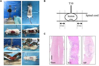 Frontiers | Methylprednisolone Induces Neuro-Protective Effects via the ...