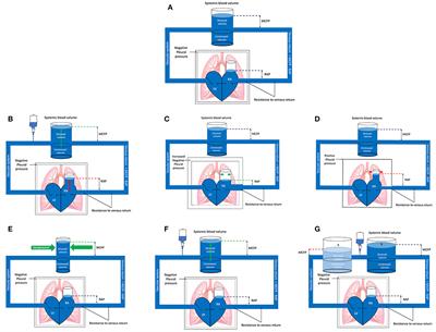 Frontiers | Assessment of Volume Status and Fluid Responsiveness in ...