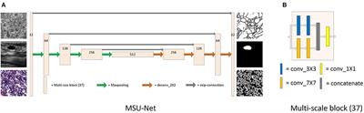 Frontiers | MSU-Net: Multi-Scale U-Net for 2D Medical Image Segmentation