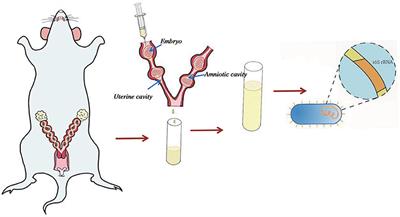 Frontiers | Changes in the Distribution of Intrauterine Microbiota May ...