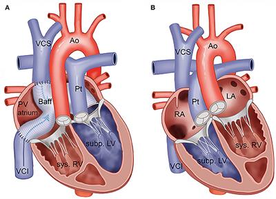 Frontiers | Validation and Feasibility of Echocardiographic Assessment ...
