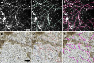 Frontiers | Quantifying Vascular Density in Tissue Engineered ...