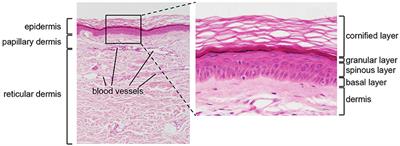 Frontiers | IL-1 Family Antagonists in Mouse and Human Skin Inflammation
