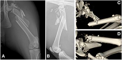 Frontiers | Case Report: Trans-Articular External Skeletal Fixation of ...